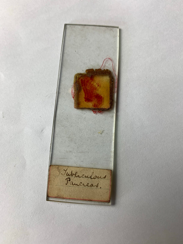 A collection of rare human pathology microscope slides - Belle and ...