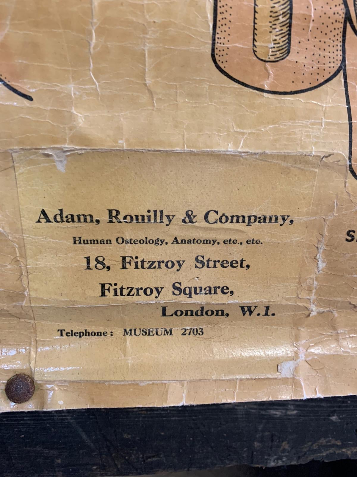 An Adam Rouilly anatomical bone fracture wall chart - Belle and Beast ...