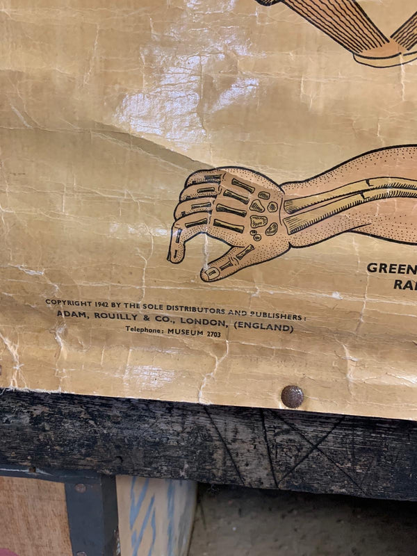 An Adam Rouilly anatomical bone fracture wall chart - Belle and Beast ...